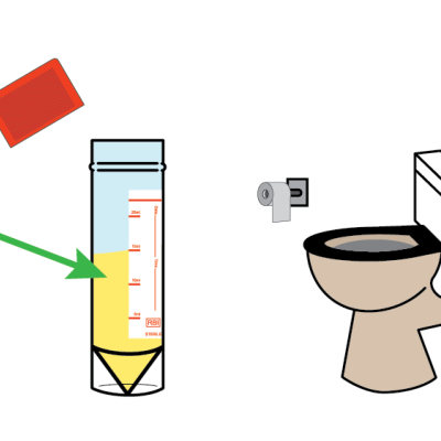 What is a urine sample? :: Lancashire and South Cumbria NHS Foundation ...